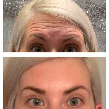 ATLANTA MEDICAL AESTHETICS - Updated November 2025 - 56 Reviews & 65 ...