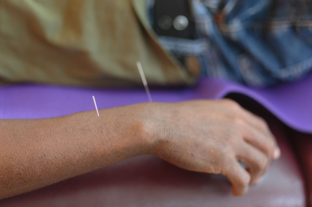 QI TREE ACUPUNCTURE - Updated July 2024 - 2228 Adam Clayton Powell Jr ...