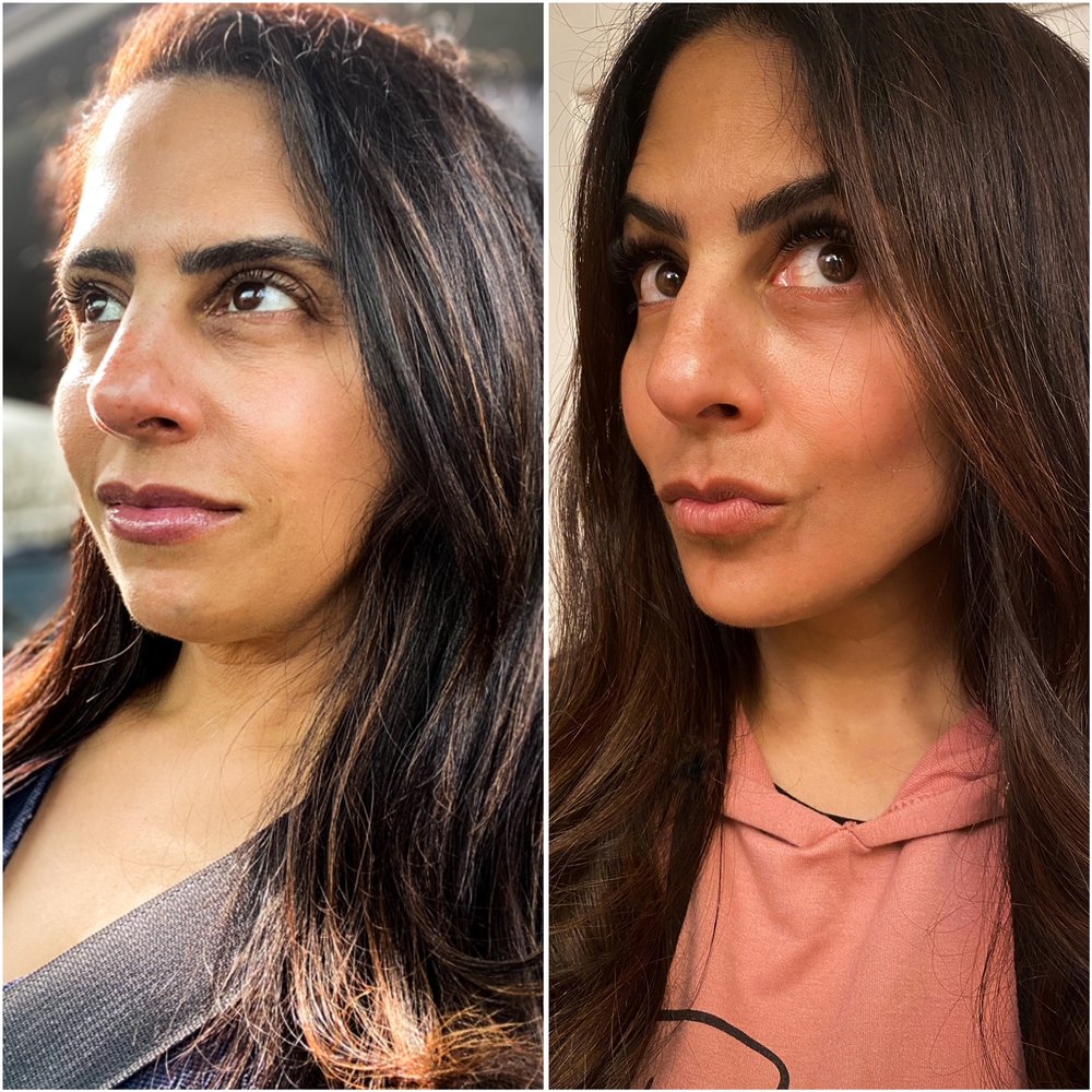 YAN TROKEL, MD - Updated October 2025 - 15 Reviews - 2 E 61st St, New ...