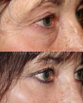 GUY MASSRY, MD - Updated May 2024 - 148 Photos & 136 Reviews - 150 N ...