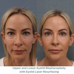 JEFFREY JOSEPH, MD - 36 Photos & 63 Reviews - Cosmetic Surgeons - 5010 ...