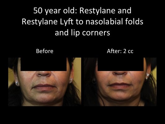 LAFACE BY LAURA PHAN, MD - Updated December 2025 - 35 Photos & 64 ...