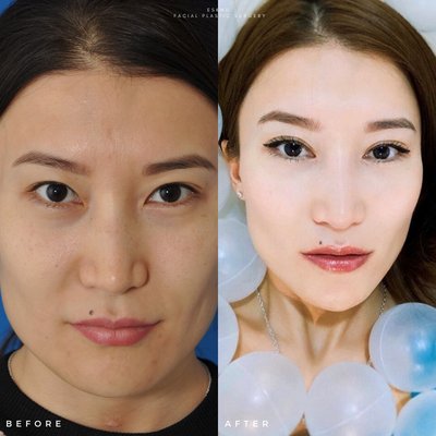 EDWARD S. KWAK MD - ESKMD FACIAL PLASTIC SURGERY - Updated June 2026 ...
