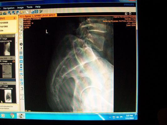 UP HEALTH SYSTEM - PORTAGE - Updated December 2025 - 11 Reviews - 500 ...