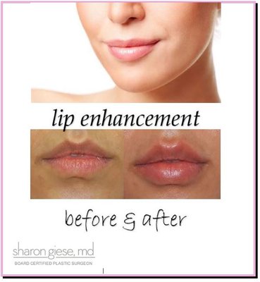 SHARON GIESE, MD - Updated April 2025 - 31 Photos & 14 Reviews - 114 ...