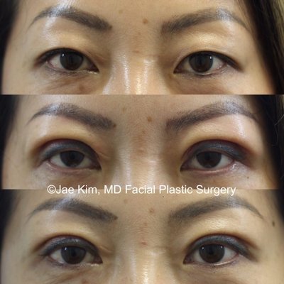 JAE KIM MD, FACIAL PLASTIC SURGERY - Updated December 2025 - 21 Photos ...
