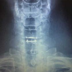 RAMIN RAISZADEH, MD - SPINE AND BRAIN INSTITUTE OF SAN DIEGO - 26 ...