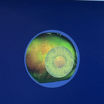 EYEDIOLOGY VISION CARE - Updated December 2025 - 77 Photos & 198 ...