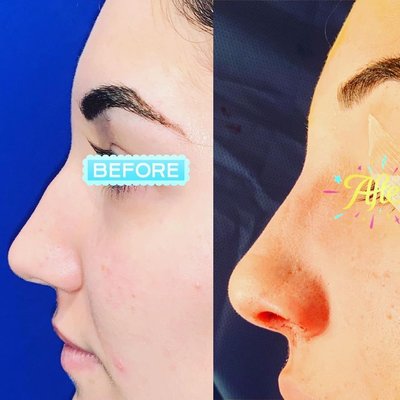 JEREMY NIKFARJAM, MD - NEW YOU PLASTIC SURGERY - Updated December 2025 ...