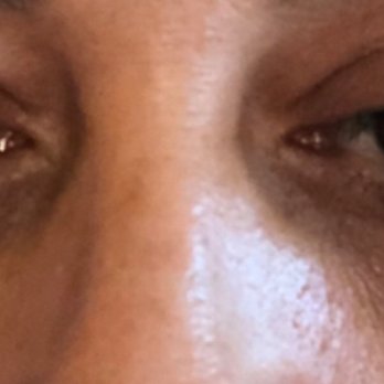 PIH HEALTH DERMATOLOGY - LA MIRADA - Updated December 2025 - 11 Reviews ...