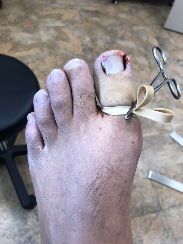 EAST TEXAS FOOT & ANKLE CENTERS - 6603 Oak Hill Blvd, Tyler, Texas ...