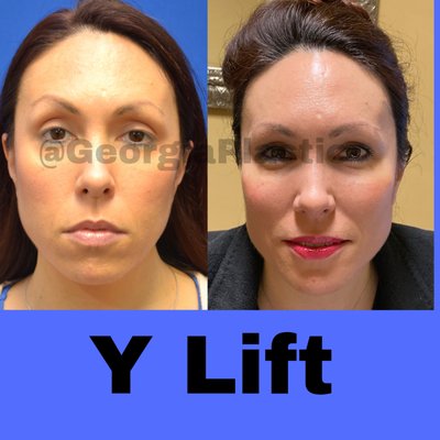 GEORGIA PLASTIC & RECONSTRUCTIVE SURGERY - Updated January 2026 - 76 ...