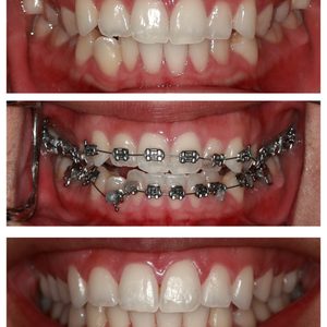 RORICK LARRY DDS - Updated June 2024 - 28 Reviews - 4110 Oceanside Blvd ...