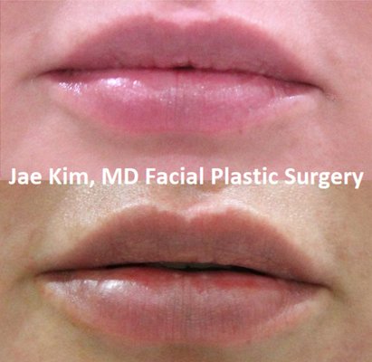 JAE KIM MD, FACIAL PLASTIC SURGERY - Updated January 2026 - 21 Photos ...
