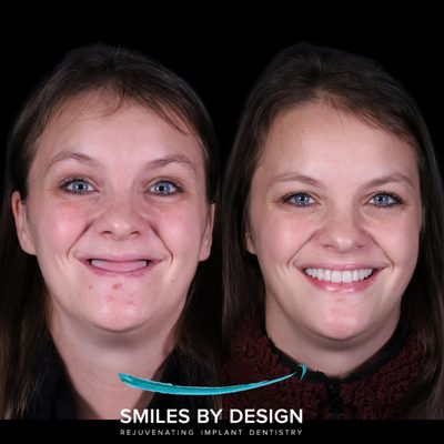 SMILES BY DESIGN - REJUVENATING IMPLANT DENTISTRY - Updated May 2026 ...