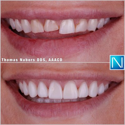 BEAM SMILE DESIGN - THOMAS NABORS, DDS & ANDREA CLEGG, DMD - 73 Photos ...