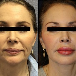 MURPHY PLASTIC SURGERY & MEDICAL SPA - 51 Photos & 26 Reviews ...