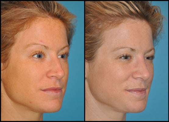 BARRY M. WEINTRAUB MD - Updated October 2025 - 64 Photos & 101 Reviews ...