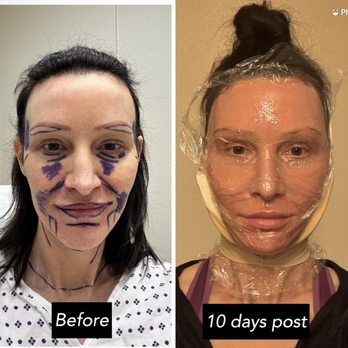 CHENG PLASTIC SURGERY - Updated October 2025 - 153 Photos & 422 Reviews ...