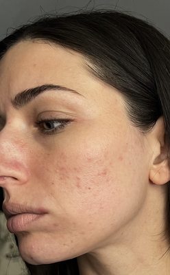 SCOTT C RACKETT, MD - MANHATTAN BEACH DERMATOLOGY - Updated November ...