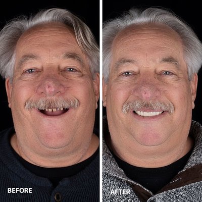 SMILE BUILDERS - Updated October 2025 - 138 Photos & 114 Reviews - Av ...