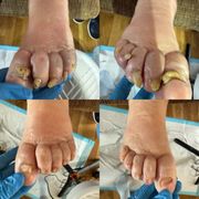 HEALTHPOINT KENT URGENT CARE - Updated August 2025 - 219 State Ave N ...