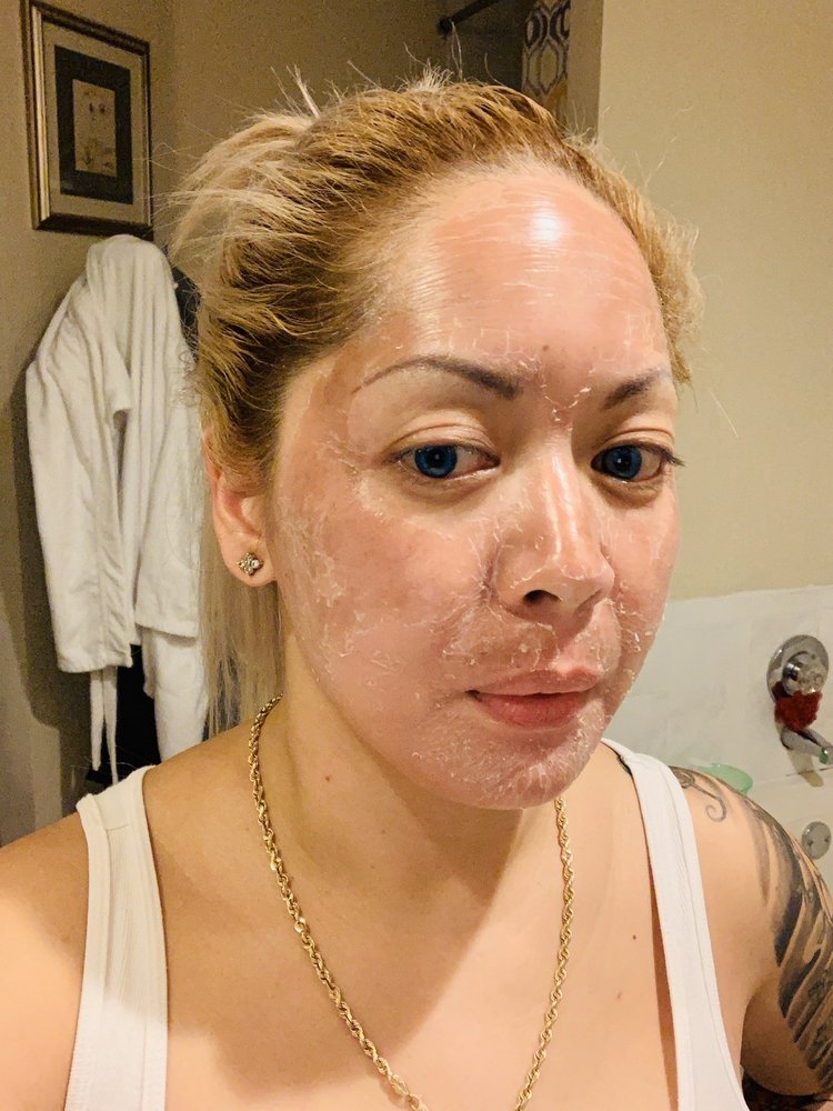 ABBY SKIN CLINIC - 124 Photos & 24 Reviews - 31881 Alvarado Blvd, Union ...
