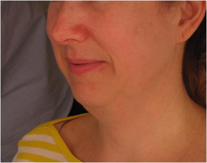 SOHEILA ROSTAMI, MD, FAAO, FAACS - Updated December 2025 - 19 Photos ...