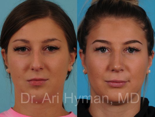 ARI HYMAN, MD - 373 Photos & 43 Reviews - 16311 Ventura Blvd, Encino ...