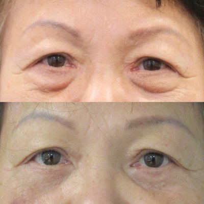 LILY LEE, MD - Updated June 2025 - 41 Photos & 16 Reviews - 73-180 El ...