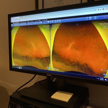 ANAHEIM OPTOMETRY - Updated June 2025 - 18 Photos & 135 Reviews - 2137 ...