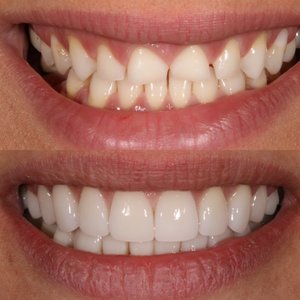 JEREMY HELDT, DDS - Updated December 2025 - 219 Photos & 104 Reviews ...