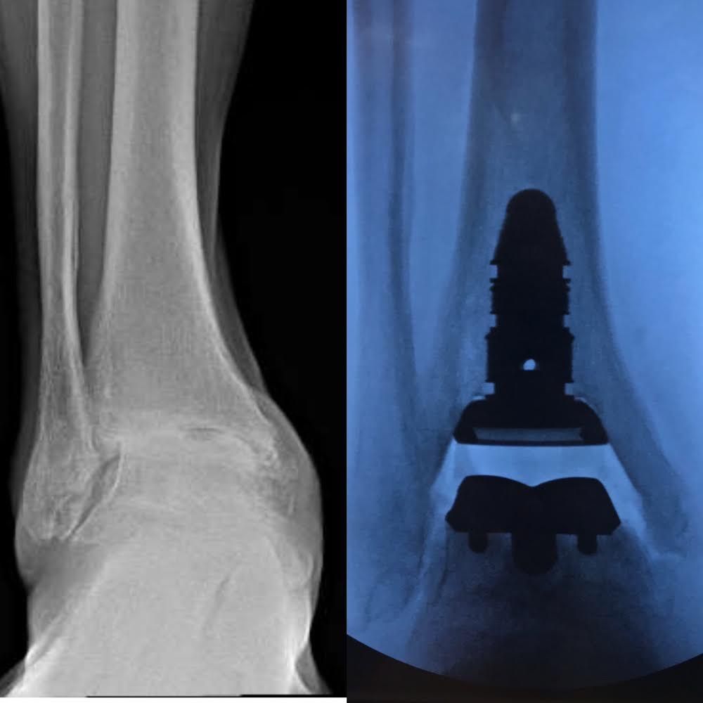 MARTINA RANDALL, DPM - Updated October 2025 - Hemet, California ...