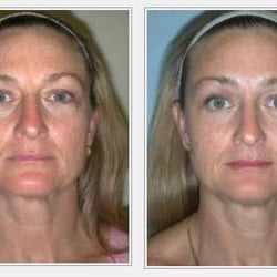 ADAM J RUBINSTEIN, MD FACS - 35 Photos & 55 Reviews - 2999 NE 191st St ...