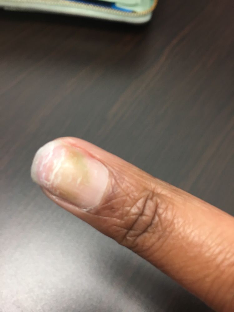 PRO TOP NAIL - Updated June 2024 - 3500 McCann Rd, Longview, Texas ...