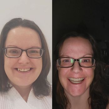 BIONIC SMILE - Updated June 2025 - 366 Photos & 12 Reviews - 4416 S ...