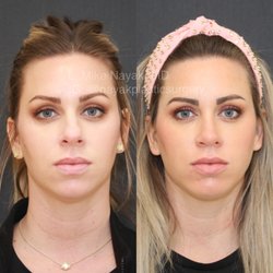 NAYAK PLASTIC SURGERY - 266 Photos & 33 Reviews - 607 S Lindbergh Blvd ...
