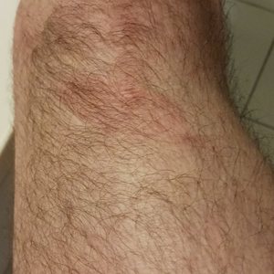 HILLTOP IMAGING - Updated October 2025 - 14 Reviews - 2970 Hilltop Mall ...