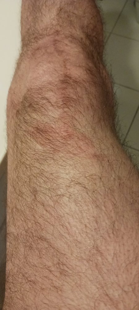 VATCHE CABAYAN, MD - Updated December 2025 - 19 Reviews - 2970 Hilltop ...