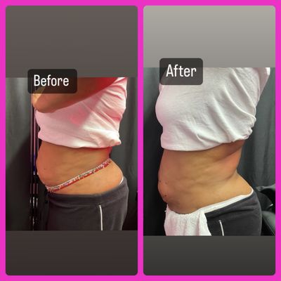 LASCULPT BODYSCULPTING SPA - Updated November 2024 - 10 Photos - 2543 ...