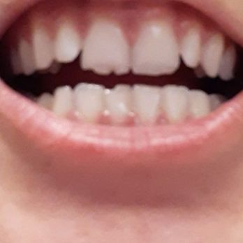 STEVEN Y LUO, DDS - Updated October 2025 - 15 Photos & 28 Reviews - 629 ...