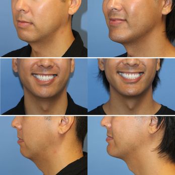 EVAN RANSOM, MD - Updated August 2025 - 126 Photos & 235 Reviews - 450 ...