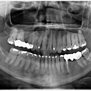 VISION SOURCE - Updated July 2025 - 16 Reviews - 1190 5th St, Wenatchee ...