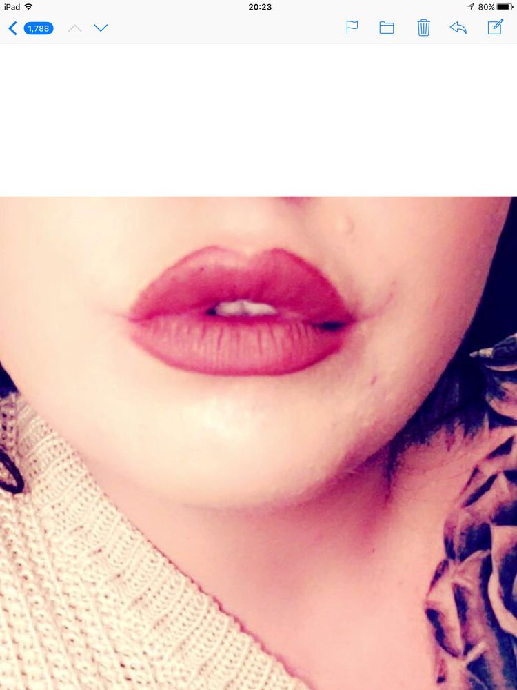 CATHY WRAY BOTOX - Updated January 2025 - Maplewell Drive, Leicester ...