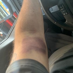 BIOLIFE PLASMA SERVICES - 26 Photos & 17 Reviews - Blood & Plasma ...