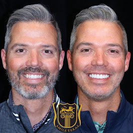 SMILE TEXAS - Updated December 2025 - 21 Photos & 15 Reviews - 4665 ...