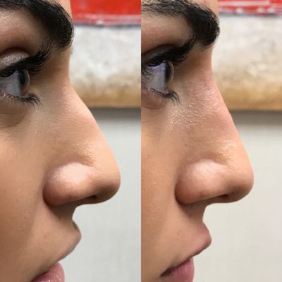 JIMMY S. FIROUZ, MD, FACS - 167 Photos & 371 Reviews - 416 N Bedford Dr ...