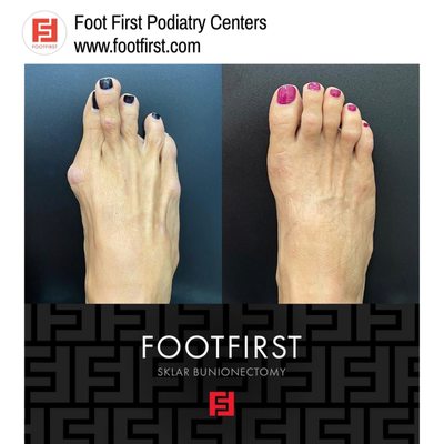 FOOT FIRST PODIATRY - Updated July 2025 - 171 Photos & 29 Reviews ...