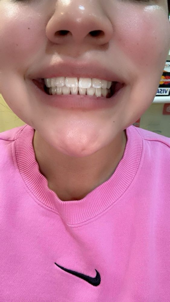 BIRVA JOSHI JONES, DDS - Updated December 2025 - 100 Reviews - 7301 ...