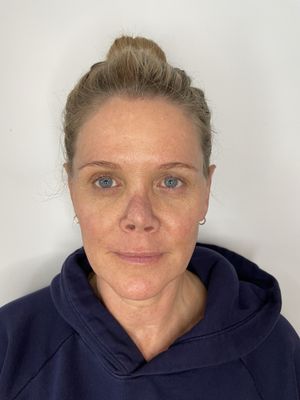 DRMICHAELKIM FACIAL PLASTIC SURGERY - Updated January 2026 - 45 Photos ...